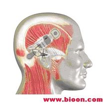 Pekak dan bisu - Pages [1] - Dunia pengetahuan ensiklopedia